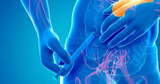 Site selection, site rotation and tips for injecting insulin - Diabetes ...